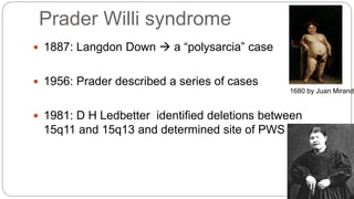 Prader Willi syndrome and Genetics and differentials | PPTX