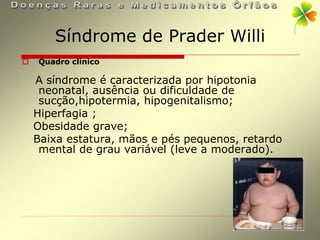 Prader willi | PDF
