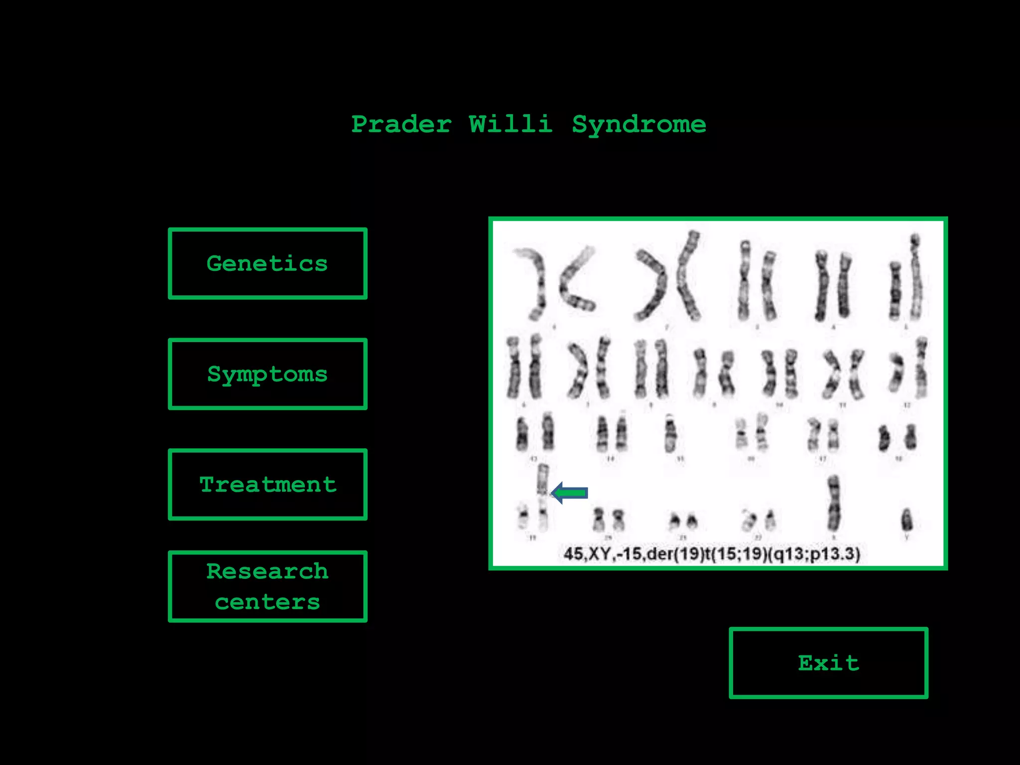 Prader Willi Syndrome: Information | PPTX