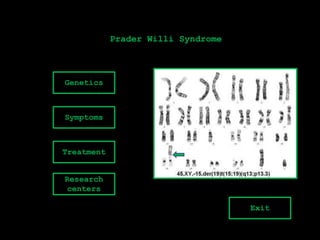 Prader Willi Syndrome: Information | PPTX