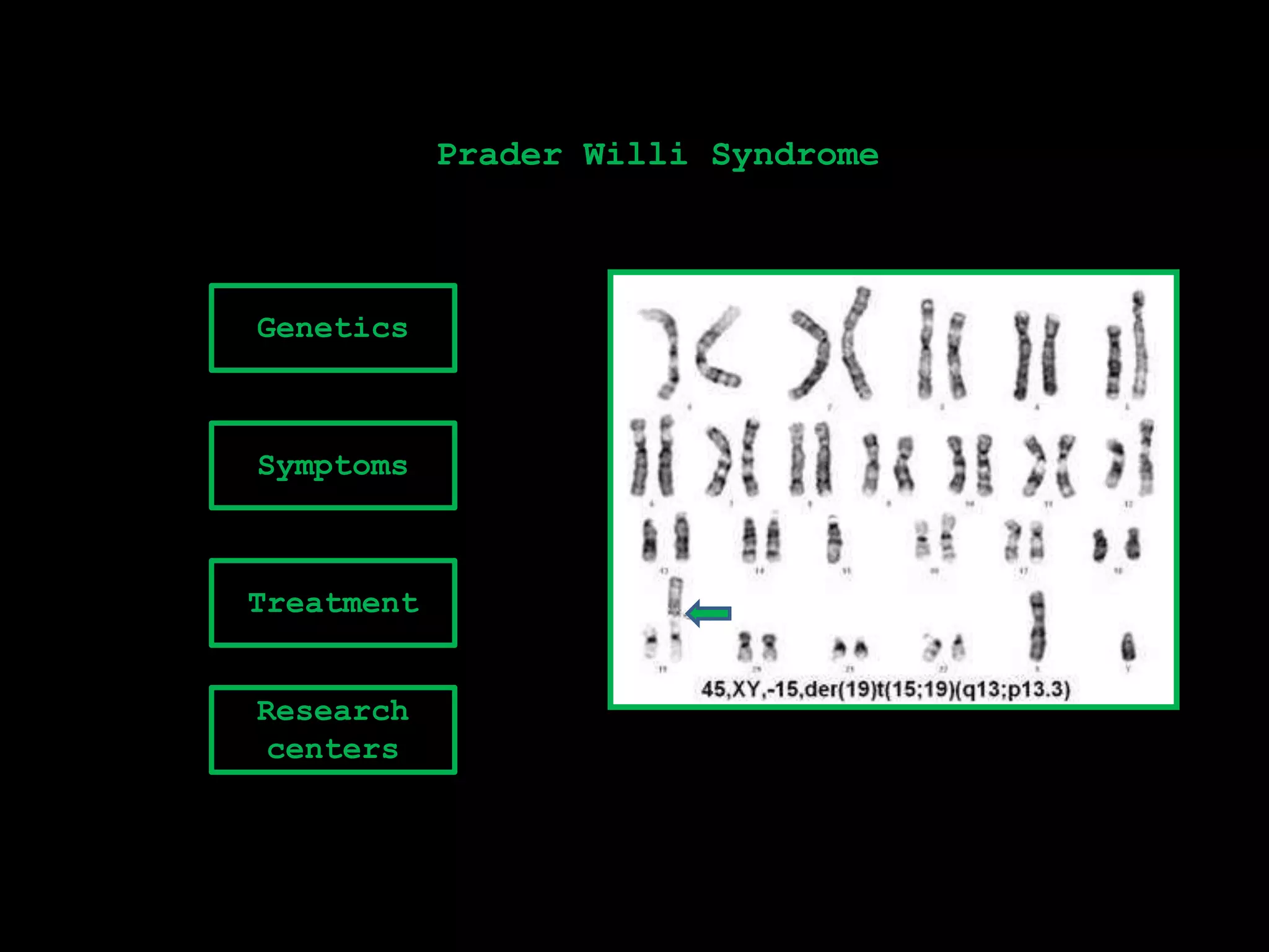 Prader Willi: Information | PPT