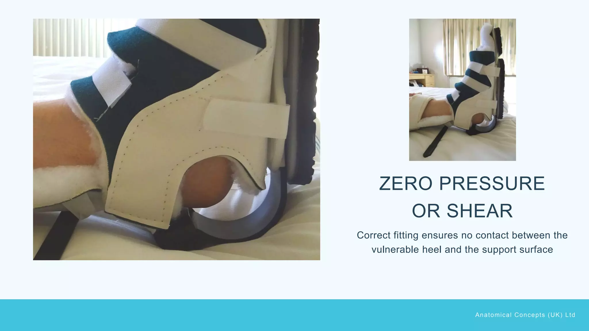 Prevention of Heel Pressure Ulcers | PPT