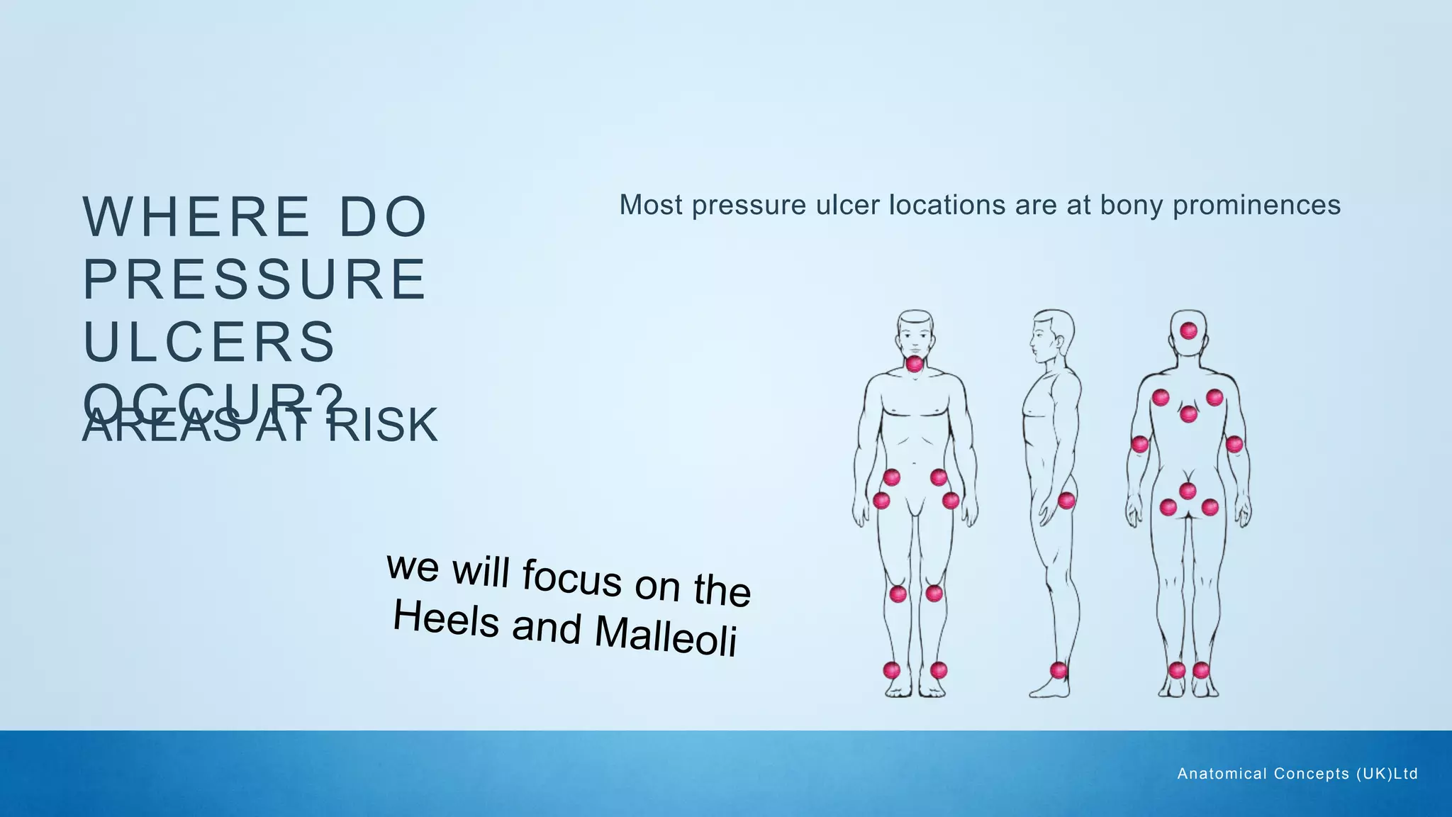Prevention of Heel Pressure Ulcers | PPT