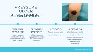 Prevention of Heel Pressure Ulcers | PPTX