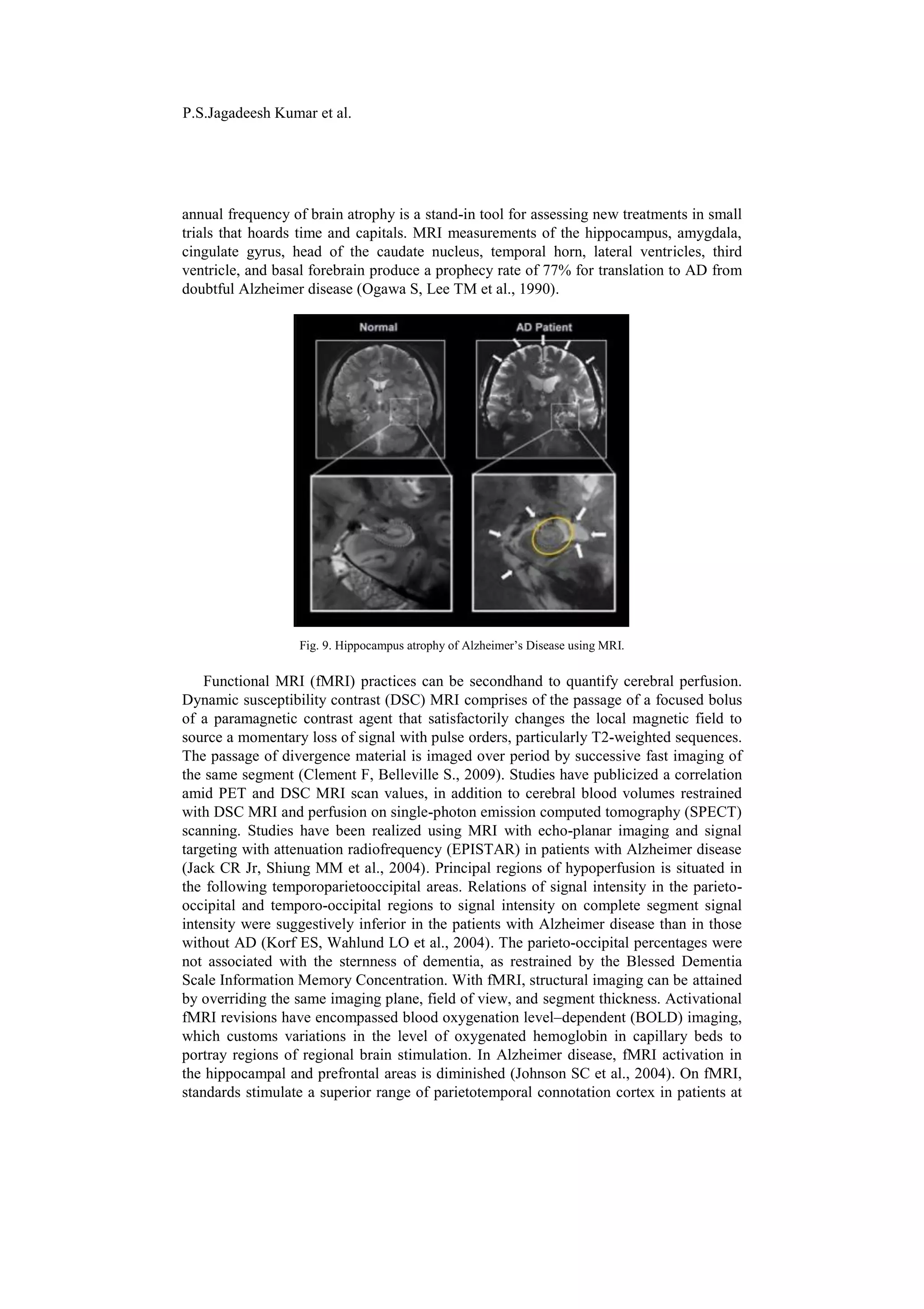 Pragmatic Realities on Brain Imaging Techniques and Image Fusion for ...