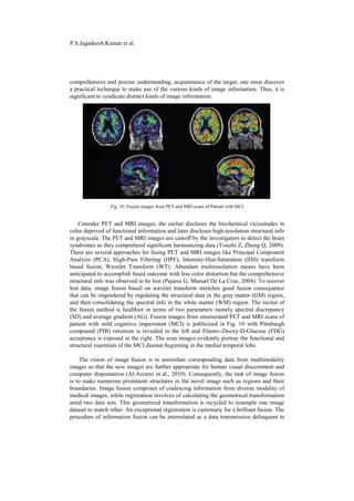 Pragmatic Realities on Brain Imaging Techniques and Image Fusion for Alzheimer’s Disease | PDF