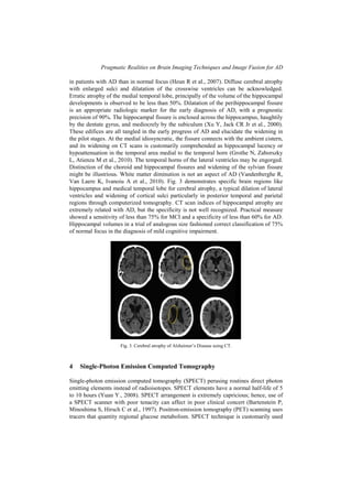 Pragmatic Realities on Brain Imaging Techniques and Image Fusion for ...