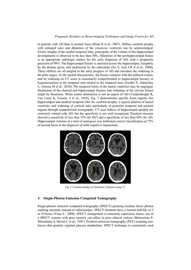 Pragmatic Realities on Brain Imaging Techniques and Image Fusion for Alzheimer’s Disease | PDF ...