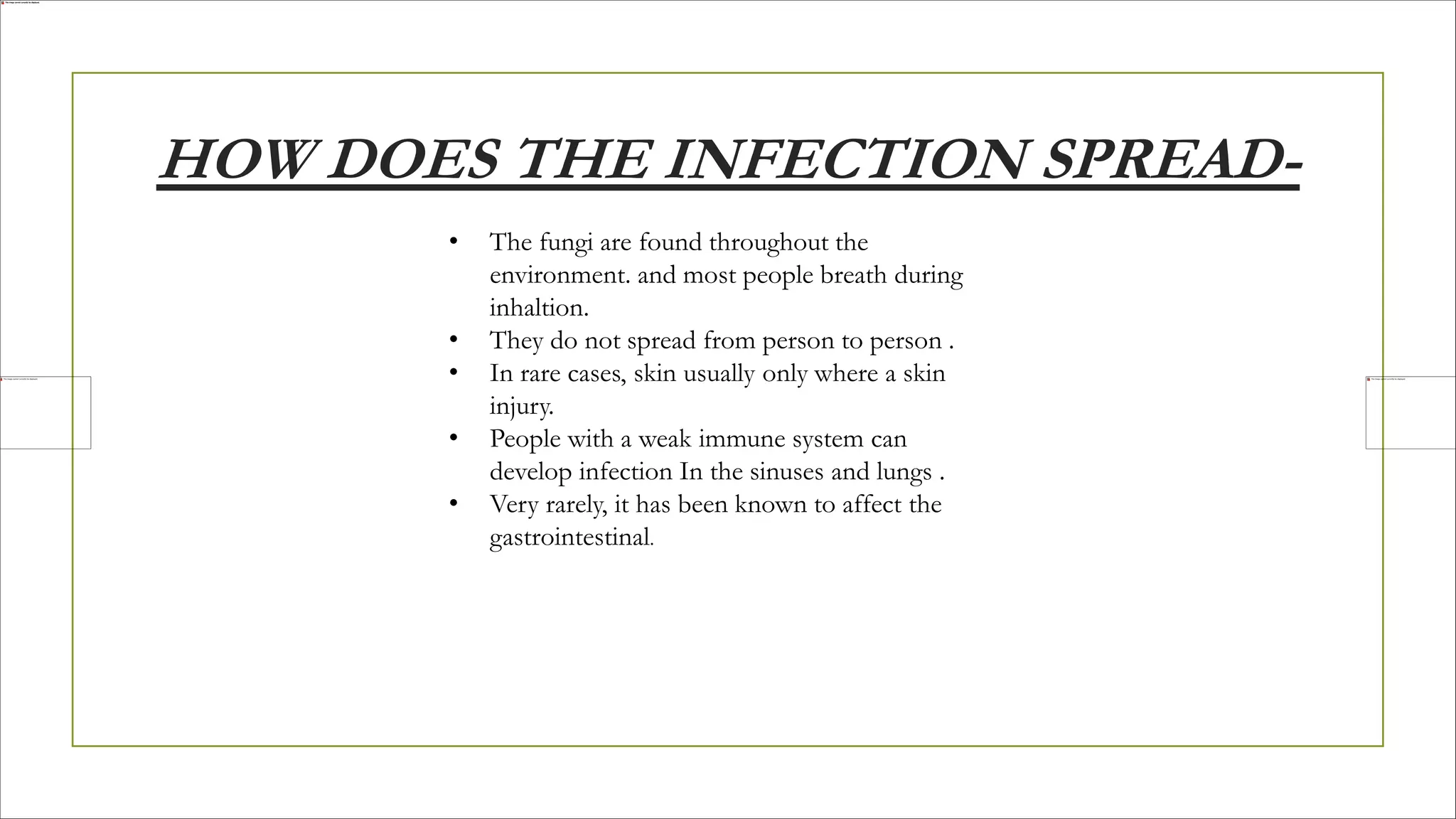 Pragya Rathore Mucormycosis.pptx