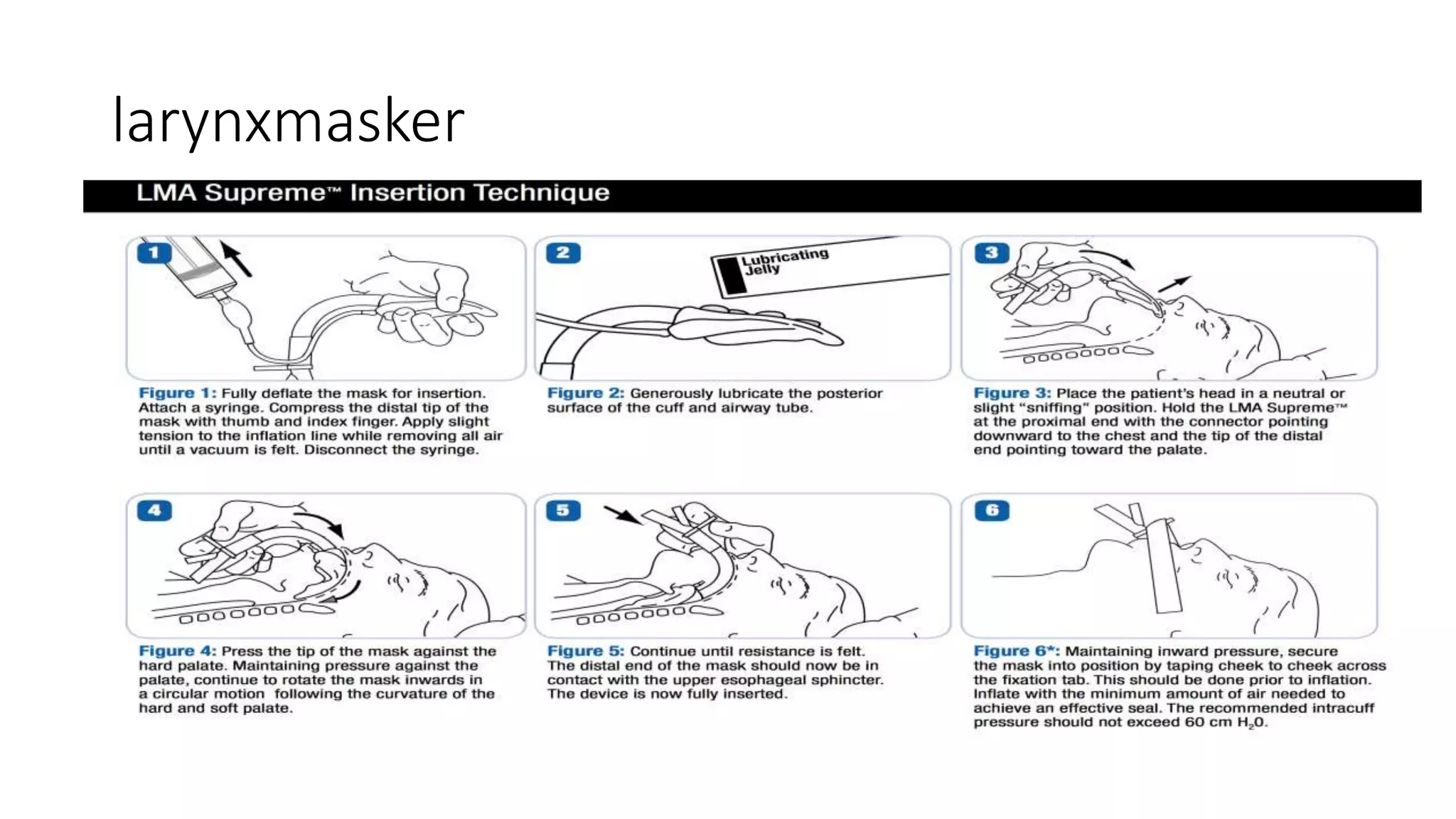 praktijk alternatieve beademing.pptx