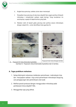 Pemeriksaan Tinja : Parasit Protozoa | PDF