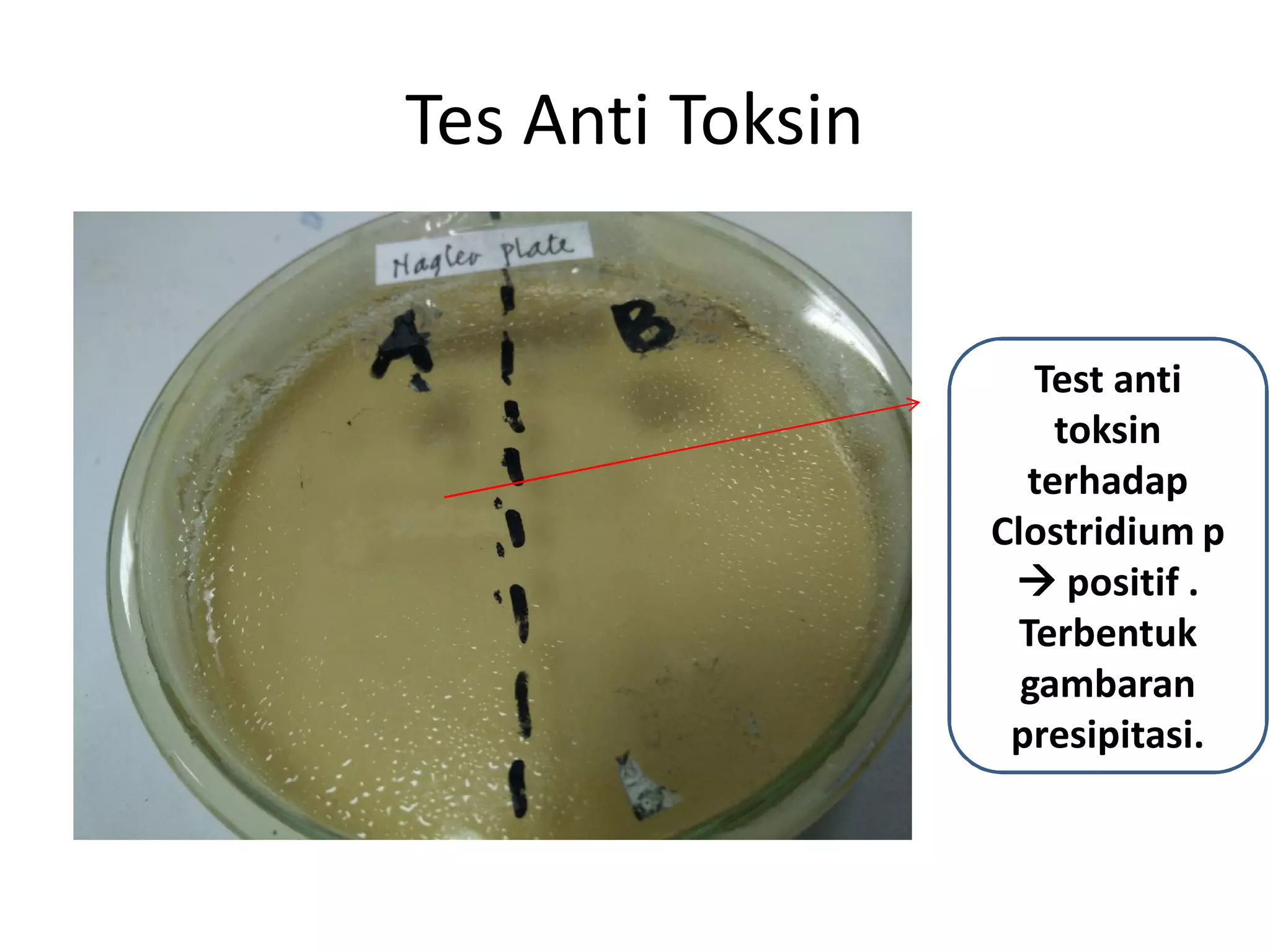 Praktikum mikrobiologi blok 17 – sistem muskoskeletal | PDF