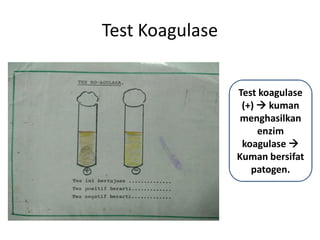 Praktikum mikrobiologi blok 17 – sistem muskoskeletal | PDF