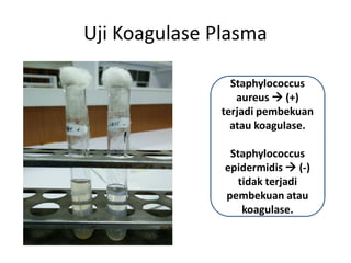 Praktikum mikrobiologi blok 17 – sistem muskoskeletal | PDF
