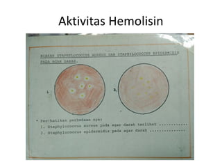 Praktikum mikrobiologi blok 17 – sistem muskoskeletal | PDF