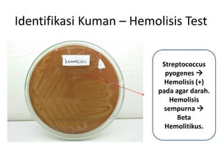 Praktikum mikrobiologi blok 17 – sistem muskoskeletal | PDF