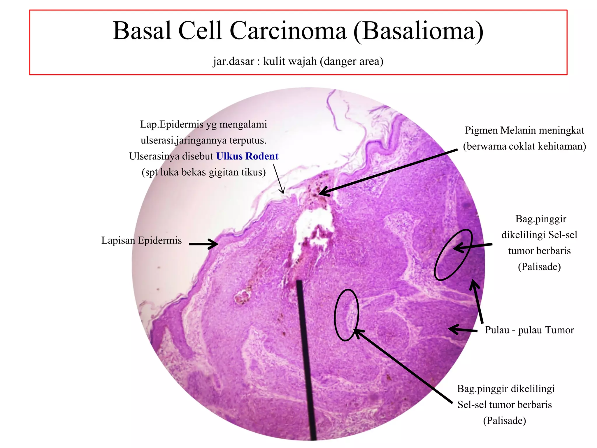 Praktikum Patologi Anatomi BLOK 20 Integumen (Kulit) | PDF