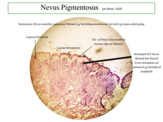 Praktikum Patologi Anatomi BLOK 20 Integumen (Kulit) | PDF