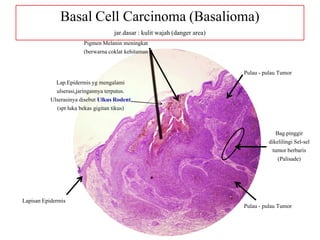Praktikum Patologi Anatomi BLOK 20 Integumen (Kulit) | PDF