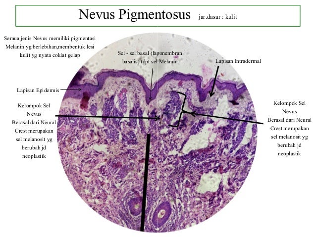 Praktikum Patologi Anatomi BLOK 20 Integumen (Kulit)