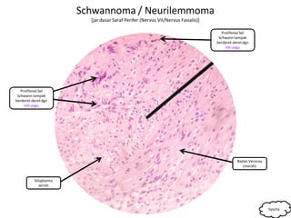 Praktikum Patologi Anatomi Blok Neurologi | PDF