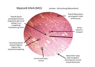 Praktikum Patologi Anatomi | PPT