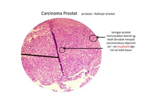 Praktikum Patologi Anatomi | PPT