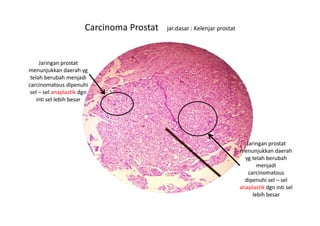 Praktikum Patologi Anatomi | PPT