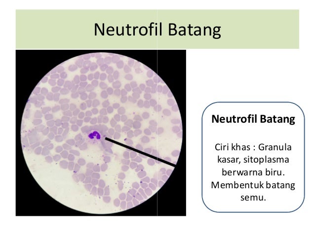 Praktikum patologi klinik blok 18