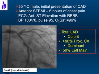 PRAMI clinical trial (for STEMI intervention) | PPT