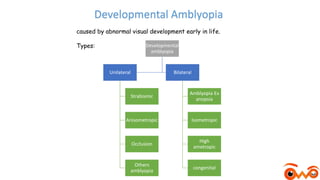 OWP Amblyopia.pptx