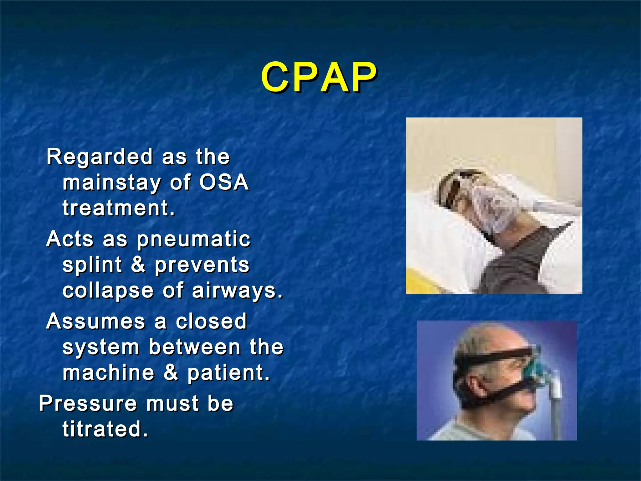 Obstructive Sleep Apnoea Diagnosis Criteria Management Ppt