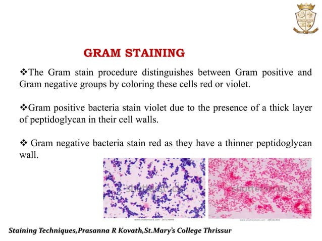 Biotechnology:Staining Techniques | PPT