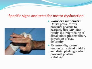 Claw Finger Deformity