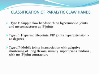 management of claw hand | PPTX