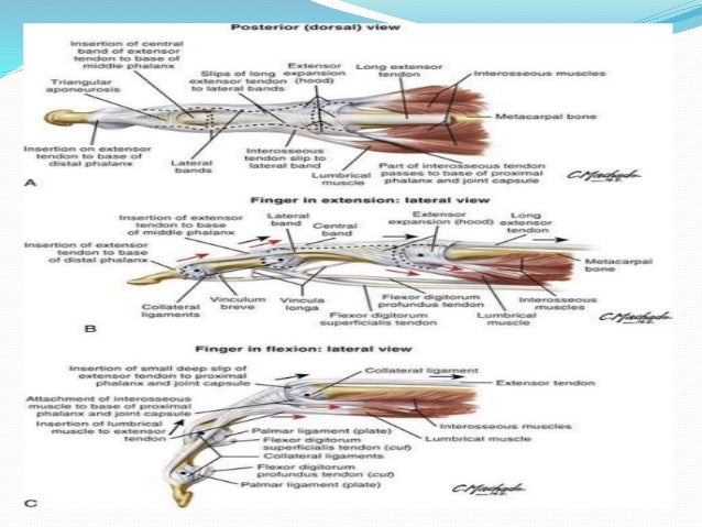management of claw hand