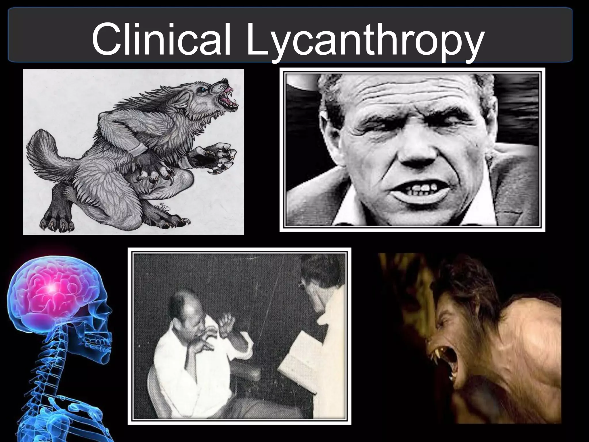 Crazy mental disorders and did you know facts about animals? | PPT