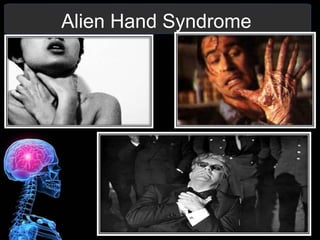 Crazy mental disorders and did you know facts about animals? | PPT