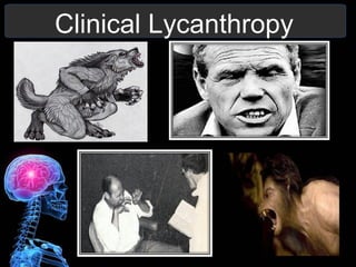 Crazy mental disorders and did you know facts about animals? | PPT