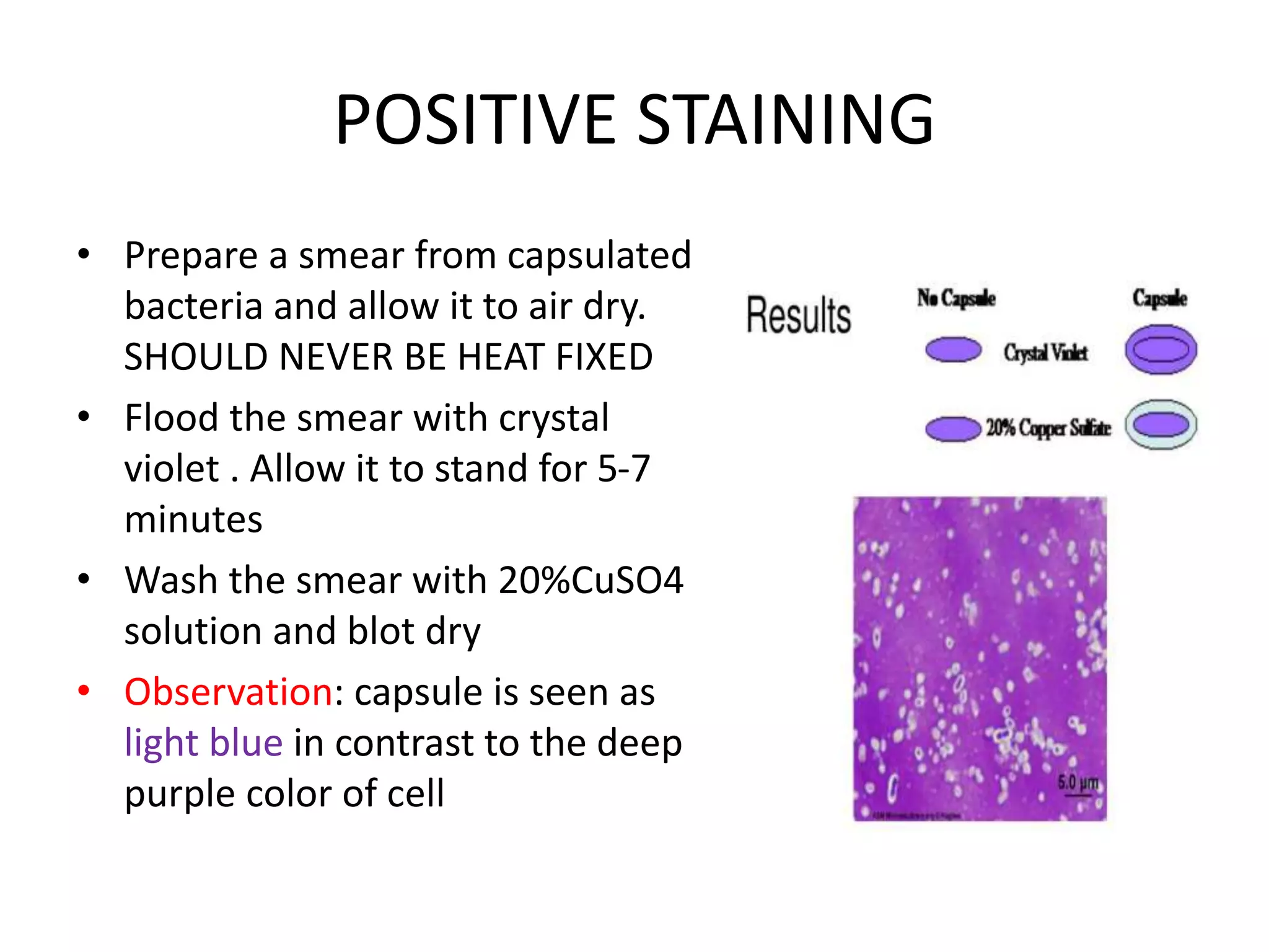SPECIAL BACTERIAL STAINING | PPTX