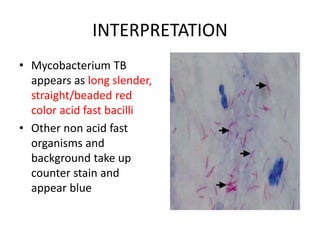 SPECIAL BACTERIAL STAINING | PPTX