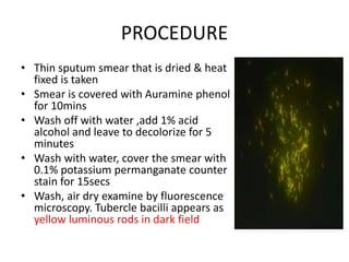 SPECIAL BACTERIAL STAINING | PPTX