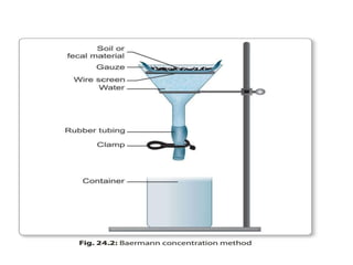 STOOL CONCENTRATION METHODS | PPTX