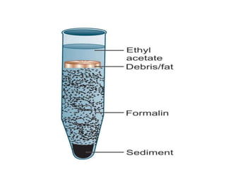 STOOL CONCENTRATION METHODS | PPTX