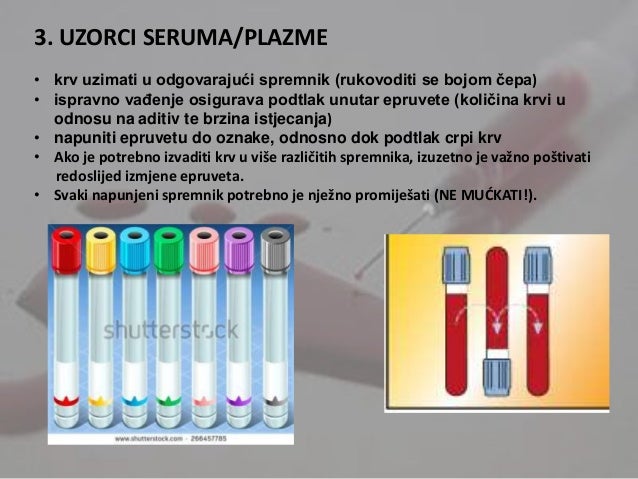 Pravilno uzorkovanje za lab