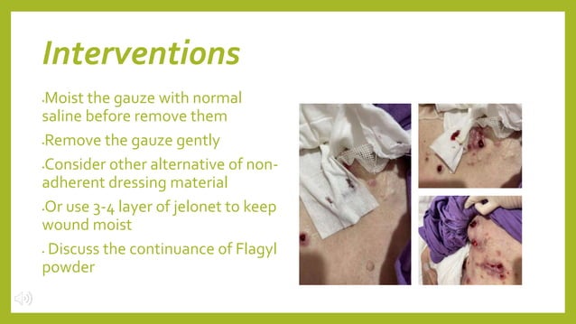 Malignant fungating wound education ppt | PPTX