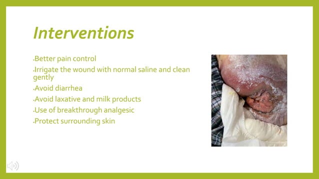 Malignant fungating wound education ppt | PPTX