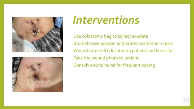 Malignant fungating wound education ppt