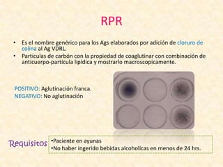 Práctica8 vdrl.rpr