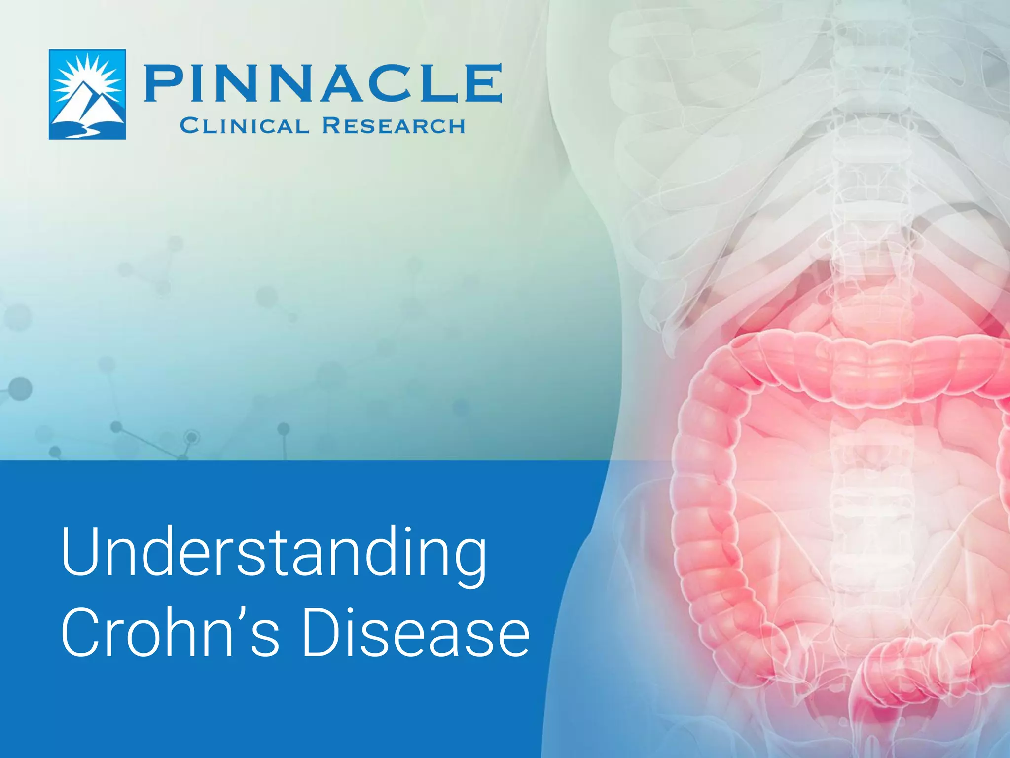 Understanding Crohns Disease Ppt